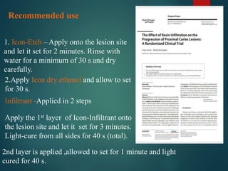 srin new point.pptx about icon caries detector infiltrant dye | PPT