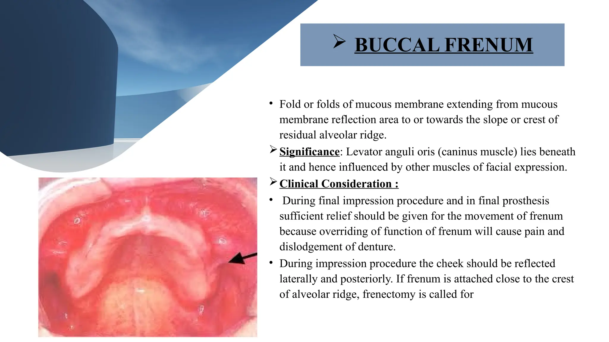 anatomic landmarks of the maxilla and mandible | PPTX