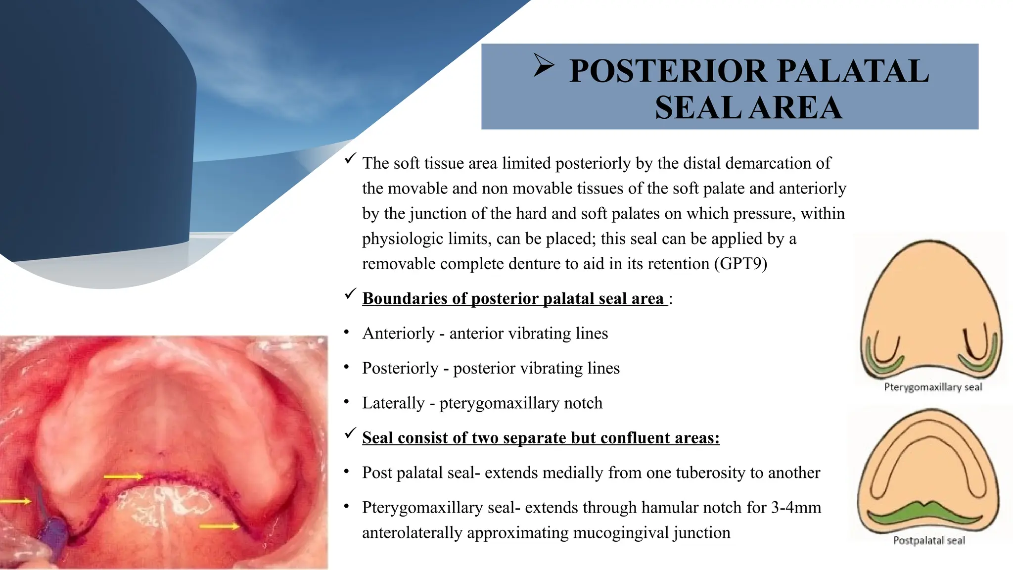 anatomic landmarks of the maxilla and mandible | PPTX