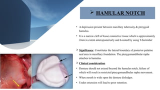 anatomic landmarks of the maxilla and mandible | PPTX | Ear, Nose and ...