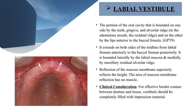 anatomic landmarks of the maxilla and mandible | PPT