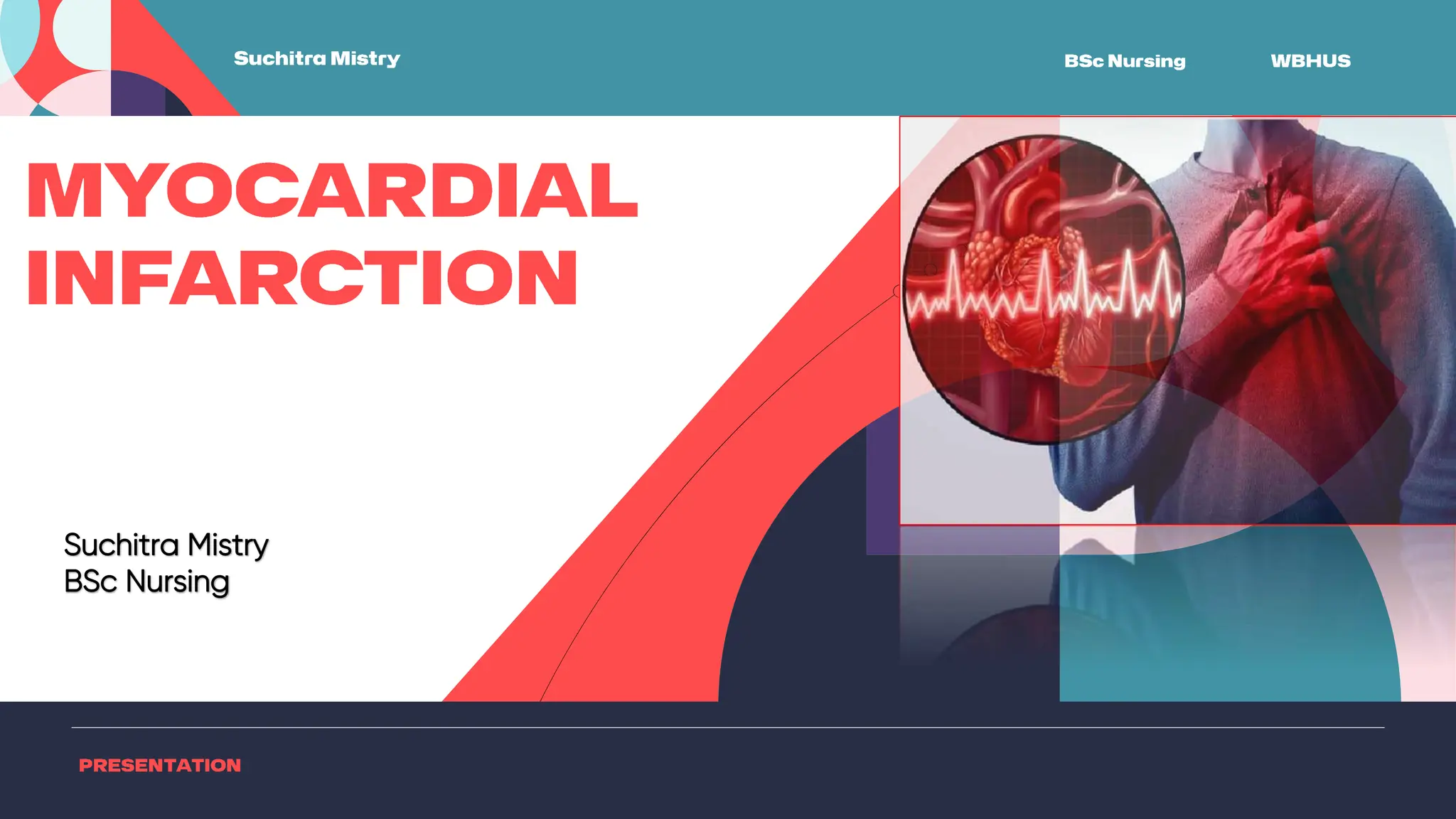 Myocardial_Infraction_Treatement_LLM.pptx