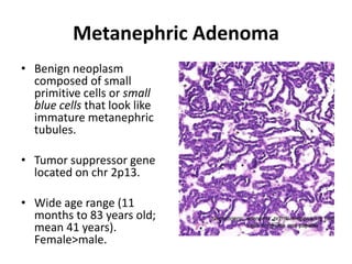 Metanephric Adenoma Pathology Outlines