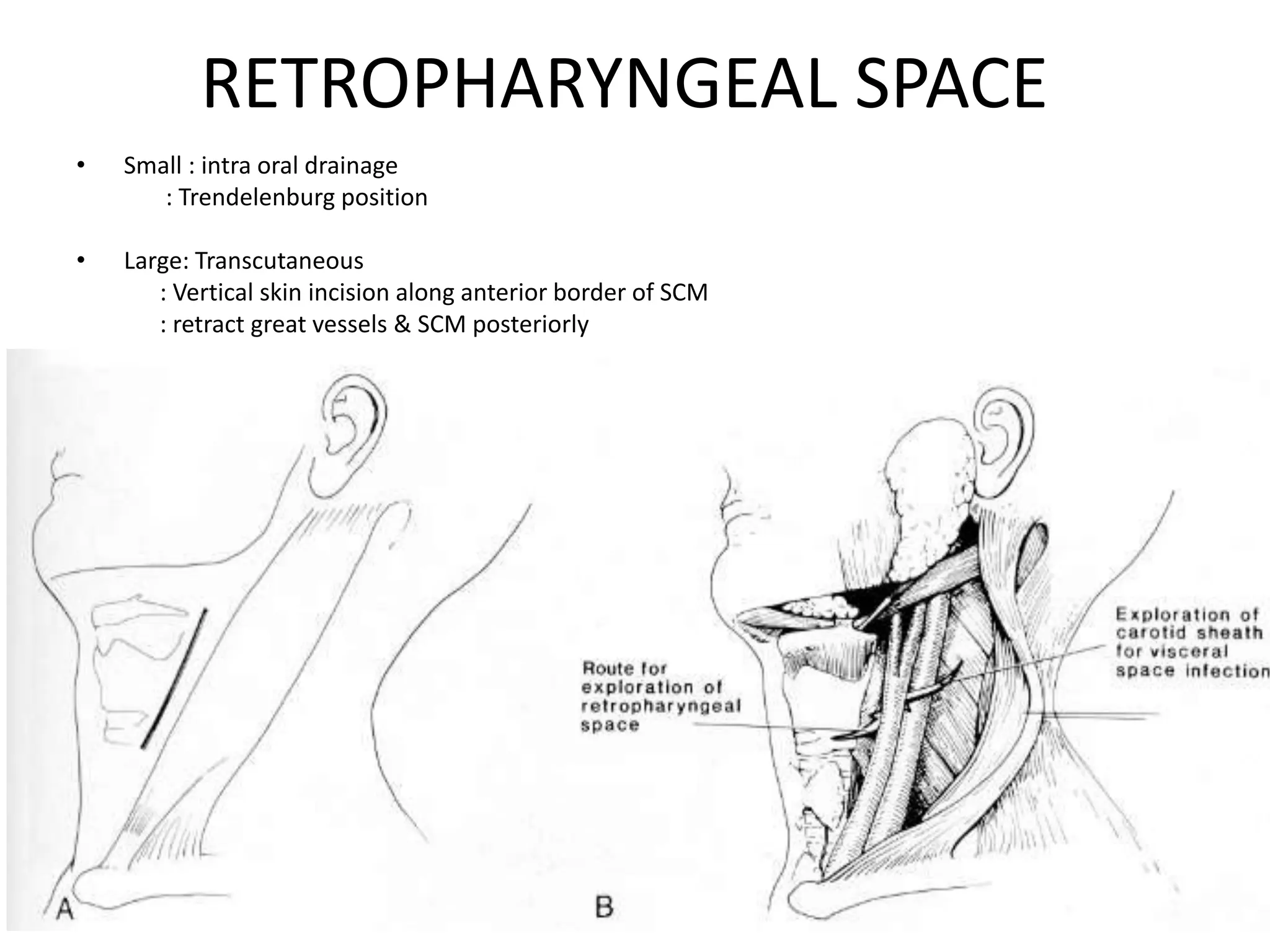 srp head and neck space infections UG.pptx