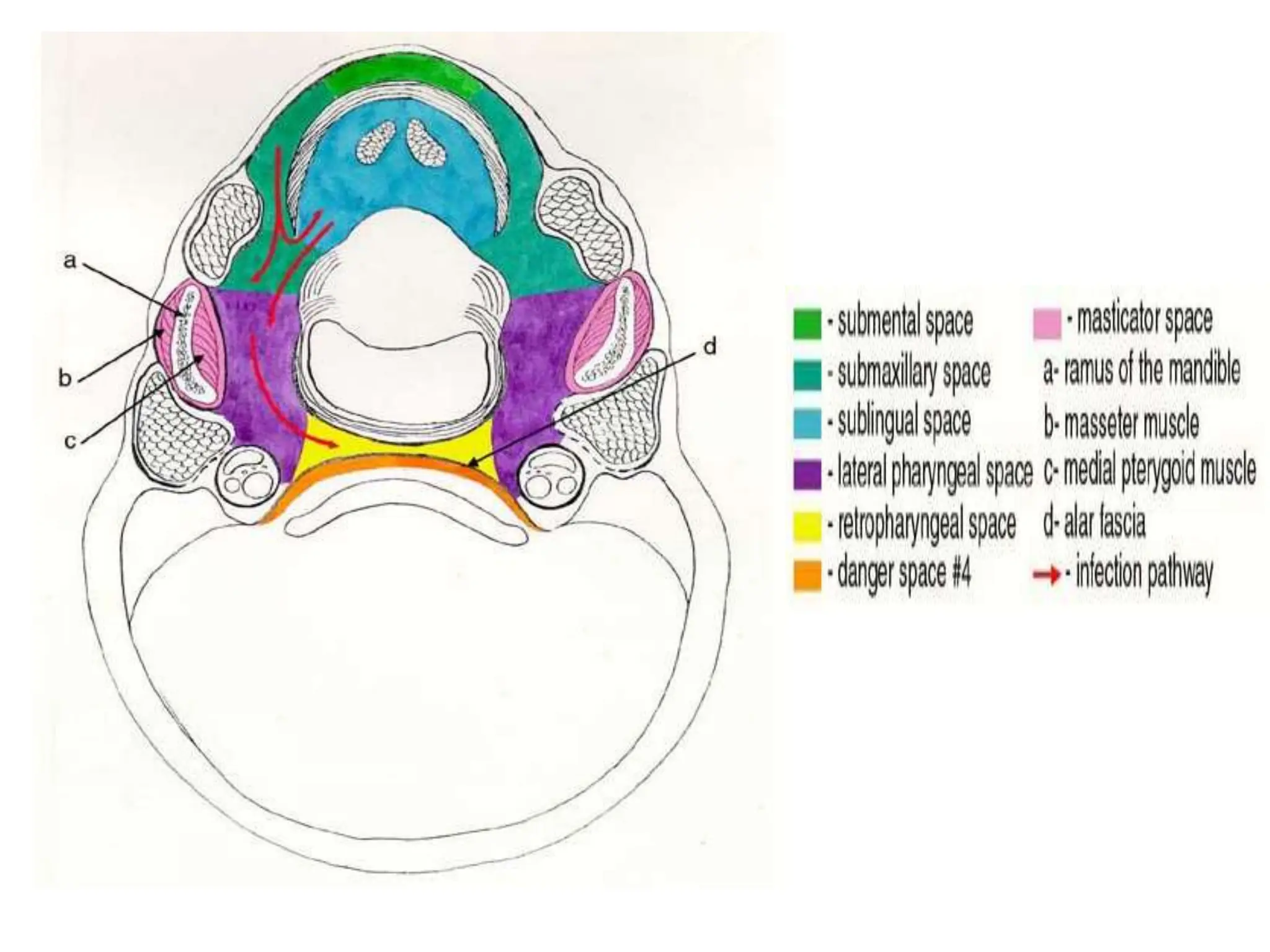 srp head and neck space infections UG.pptx