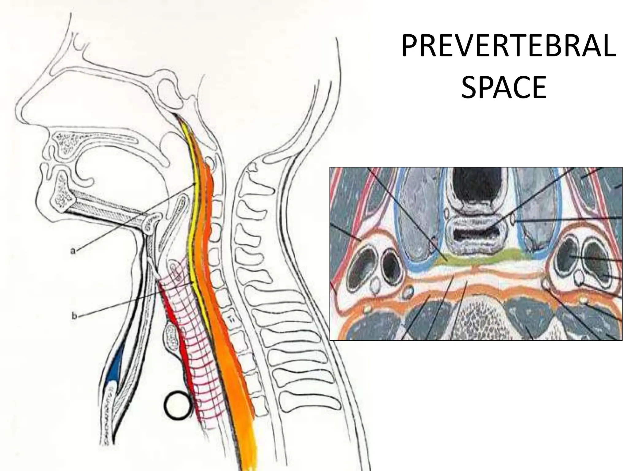 srp head and neck space infections UG.pptx