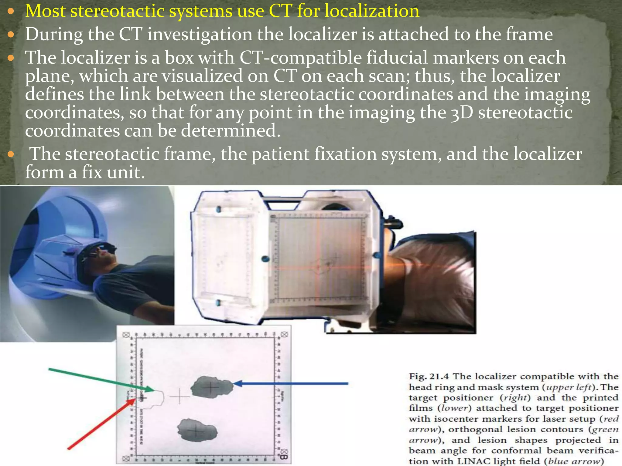 Stereotactic Radiosurgery/ Radiotherapy | PPTX