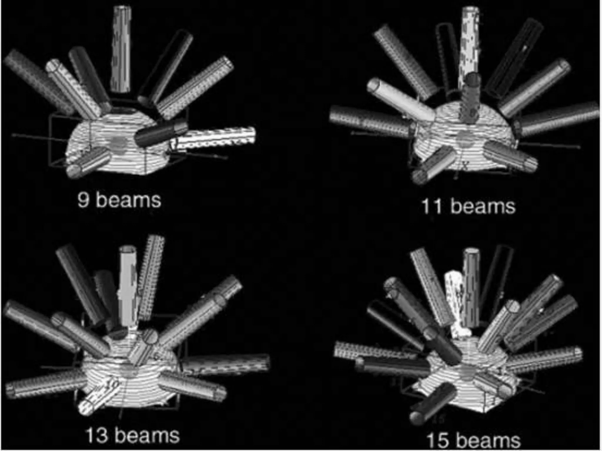 Stereotactic Radiosurgery/ Radiotherapy | PPTX
