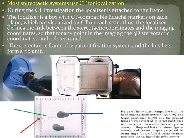 Stereotactic Radiosurgery/ Radiotherapy | PPTX | Cancer | Diseases and ...