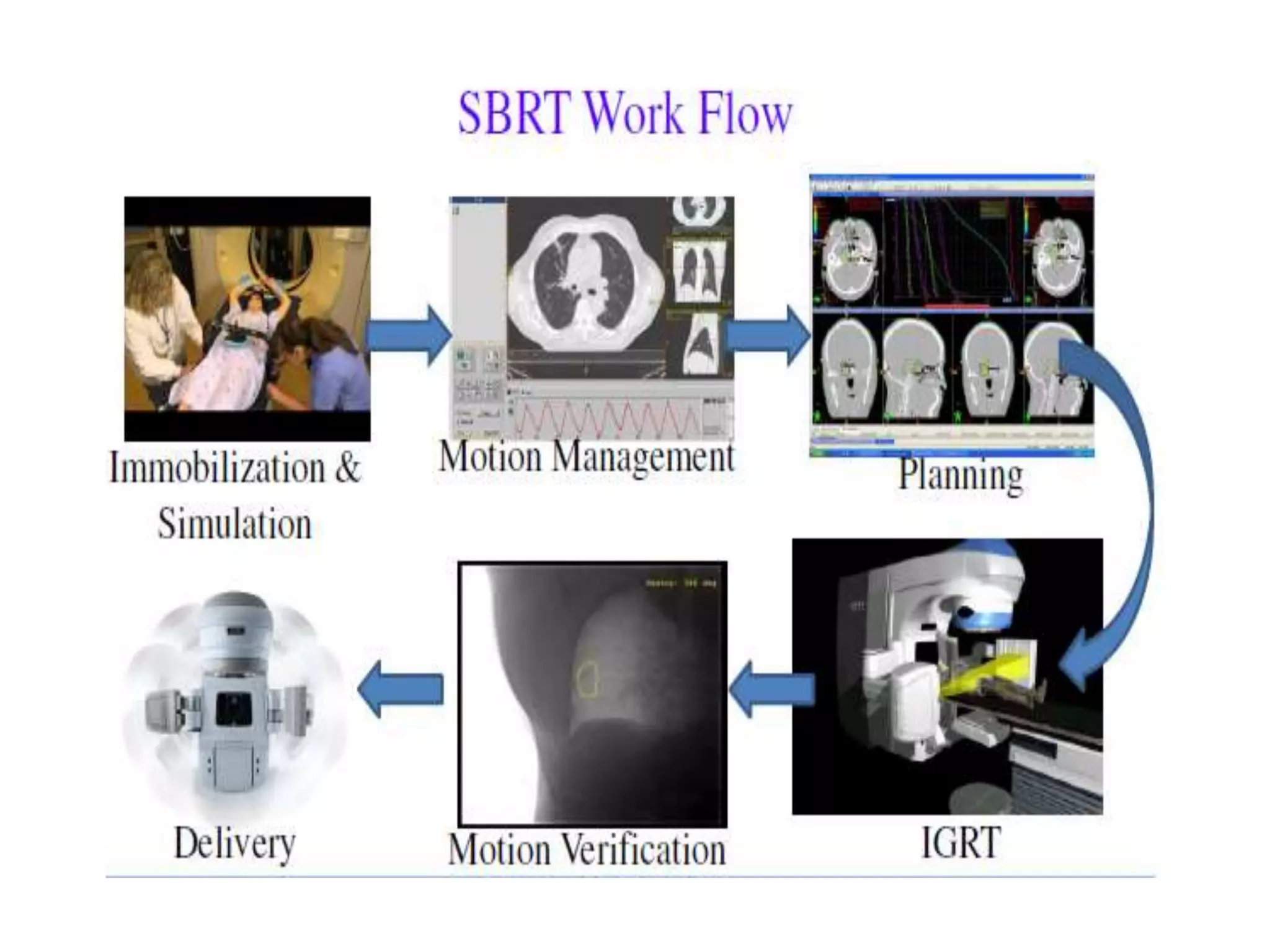 Srs and sbrt 2 dr.kiran | PPTX