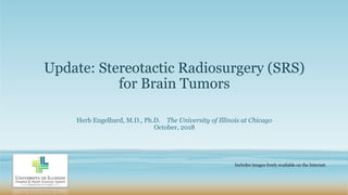 SRS for brain tumors 2018 public | PPTX