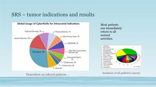 SRS for brain tumors 2018 public | PPTX