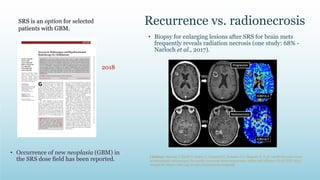 SRS for brain tumors 2018 public | PPTX