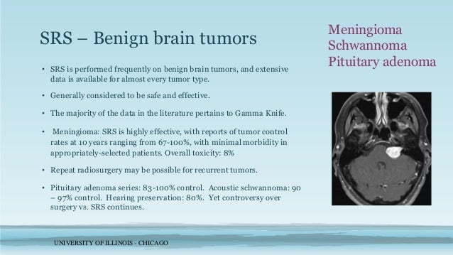 SRS for brain tumors 2018 public