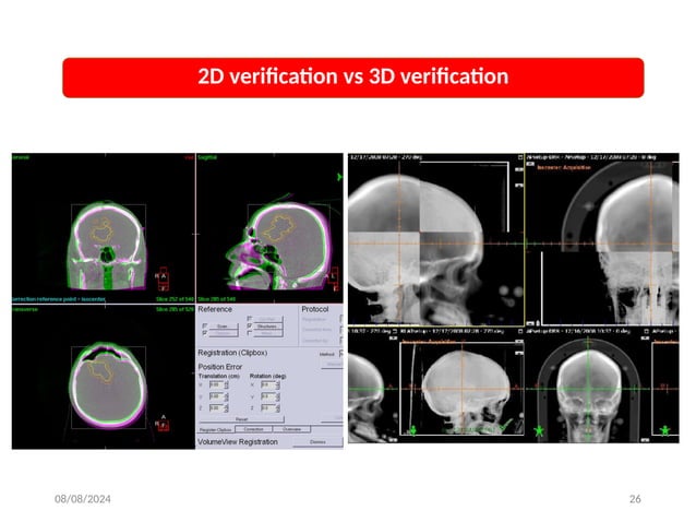 SRS PLAN METRICS BY DR KANHU CHARAN PATRO | PPTX | Cancer | Diseases ...