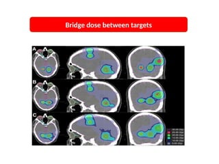 SRS PLAN METRICS BY DR KANHU CHARAN PATRO | PPTX