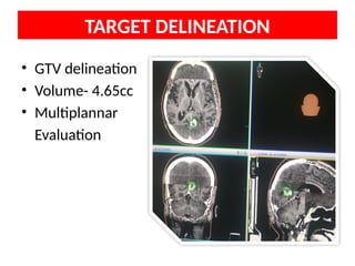 SRS PLAN METRICS BY DR KANHU CHARAN PATRO | PPTX