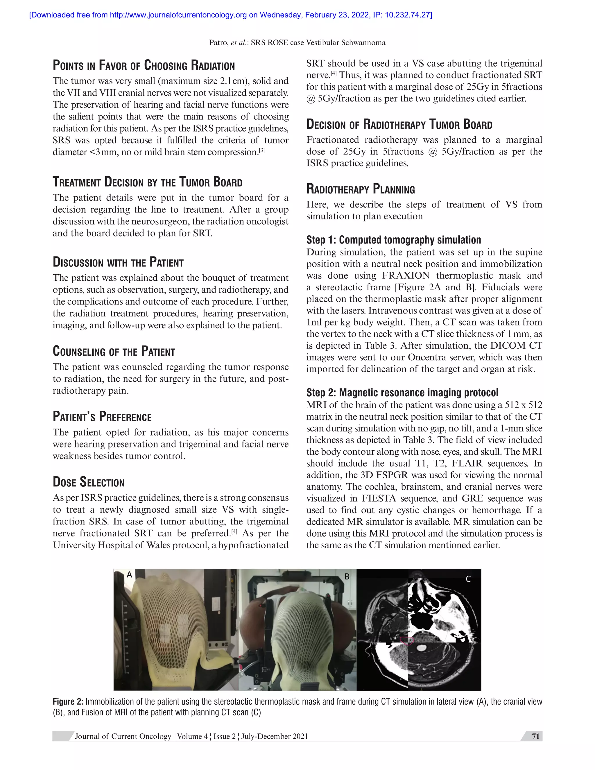 Step-by-Step Stereotactic Radiotherapy Planning of Vestibular ...