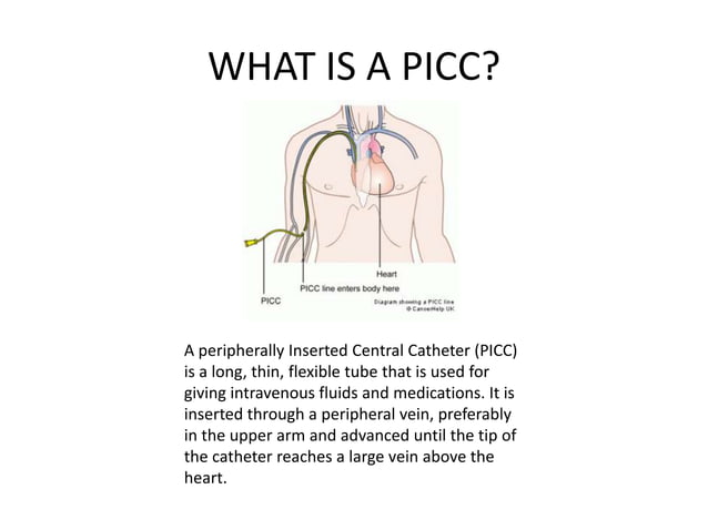 Srt piccs | PPT