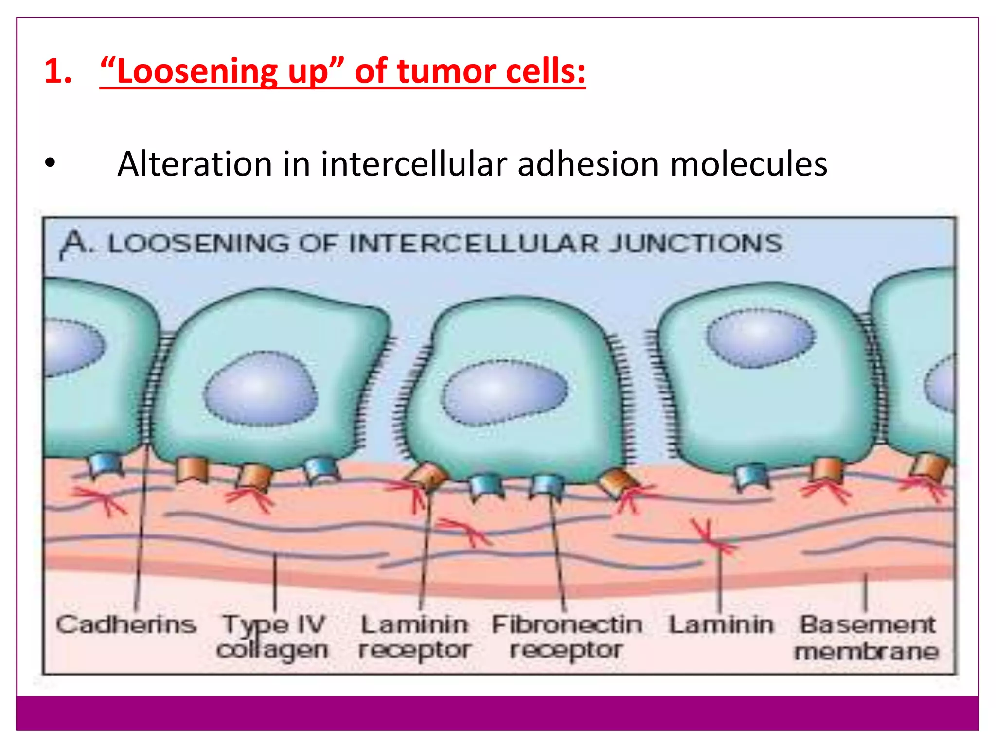 Metastatic cascade and Epithelial Mesenchymal Transition | PPTX