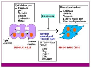 Epithelial Mesenchymal Transition Ppt