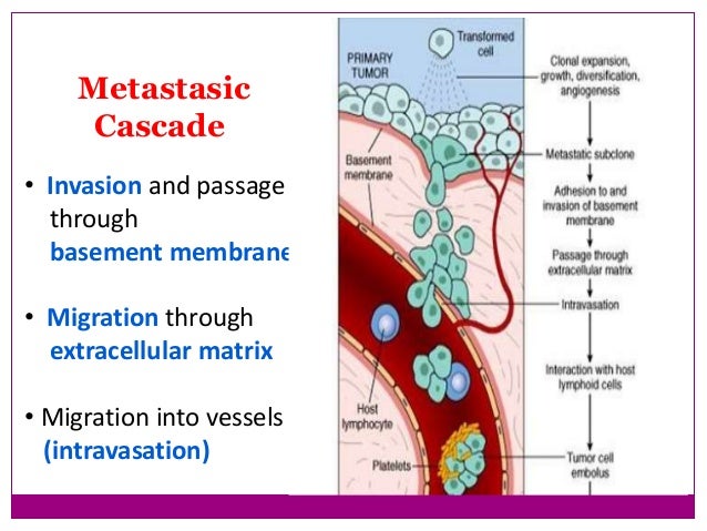 Metastatic cascade and Epithelial Mesenchymal Transition
