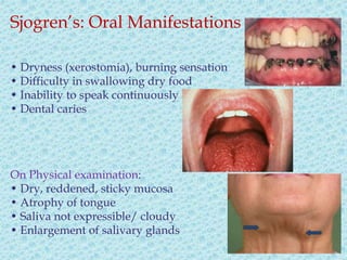 Sjogren’S Syndrome Dry Throat Treatment – UCBM