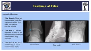Fractures and Dislocations of Foot - Dr Sunkappa SR | PPTX