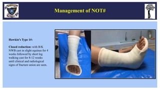 Fractures and Dislocations of Foot - Dr Sunkappa SR | PPTX