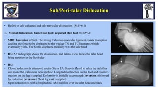 Fractures and Dislocations of Foot - Dr Sunkappa SR | PPTX