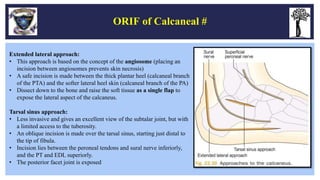 Fractures and Dislocations of Foot - Dr Sunkappa SR | PPTX