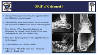Fractures and Dislocations of Foot - Dr Sunkappa SR | PPTX