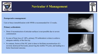 Fractures and Dislocations of Foot - Dr Sunkappa SR | PPTX