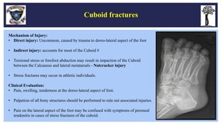 Fractures and Dislocations of Foot - Dr Sunkappa SR | PPTX