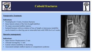 Fractures and Dislocations of Foot - Dr Sunkappa SR | PPTX
