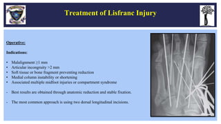 Fractures and Dislocations of Foot - Dr Sunkappa SR | PPTX