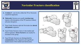 Fractures and Dislocations of Foot - Dr Sunkappa SR | PPT