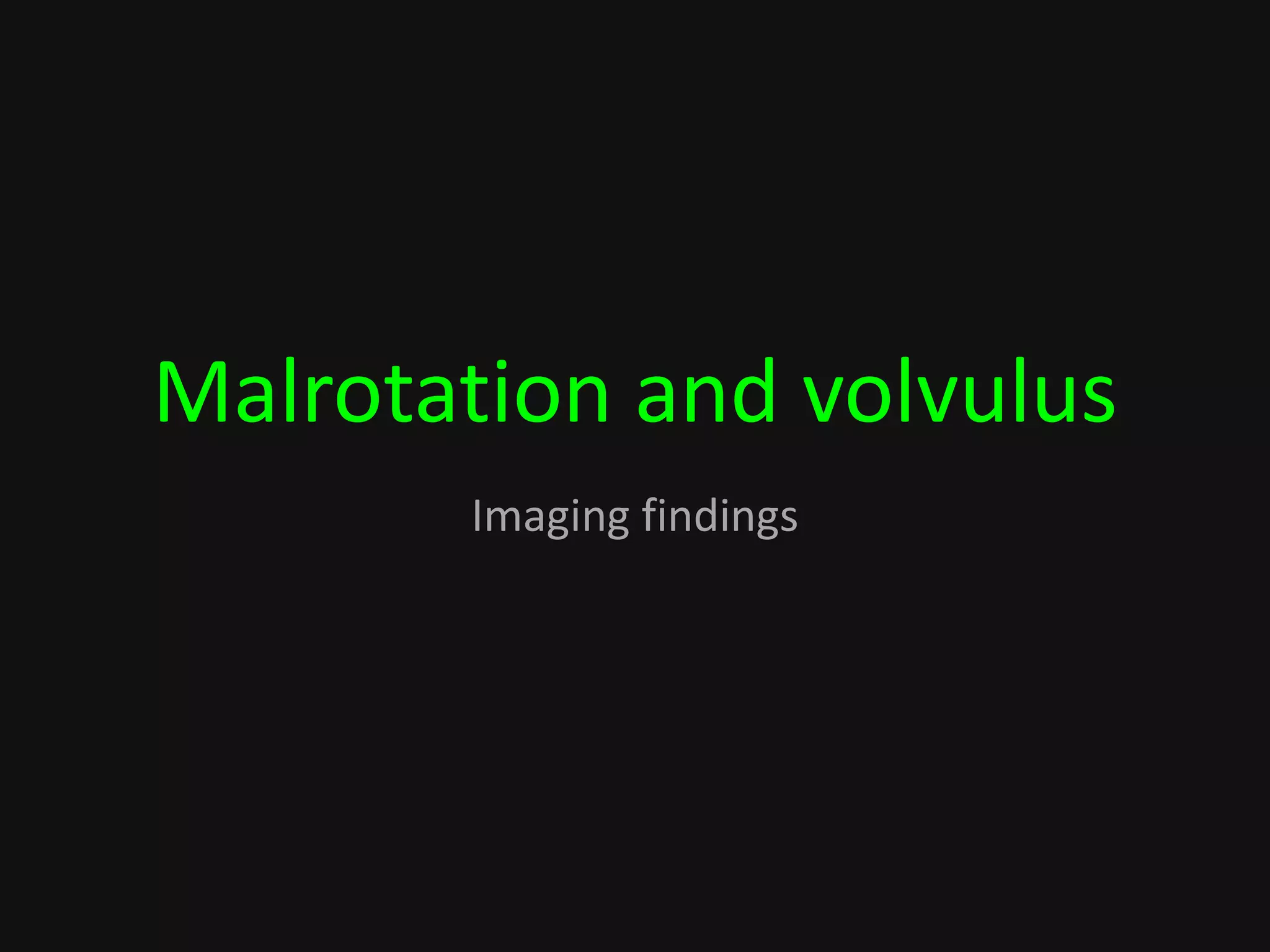 Malrotation and volvulus - imaging findings | PPTX