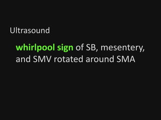 Malrotation and volvulus - imaging findings | PPTX