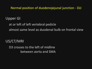 Malrotation and volvulus - imaging findings | PPTX