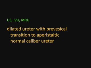 Primary megaureter - imaging findings | PPTX
