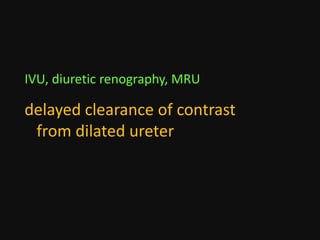 Primary megaureter - imaging findings | PPTX