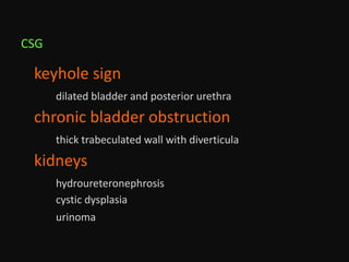 Posterior urethral valves - imaging findings | PPT