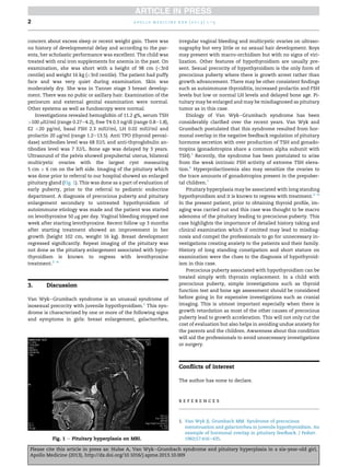 Van Wyke-Grumbach syndrome and pituitary hyperplasia in a six-year-old ...