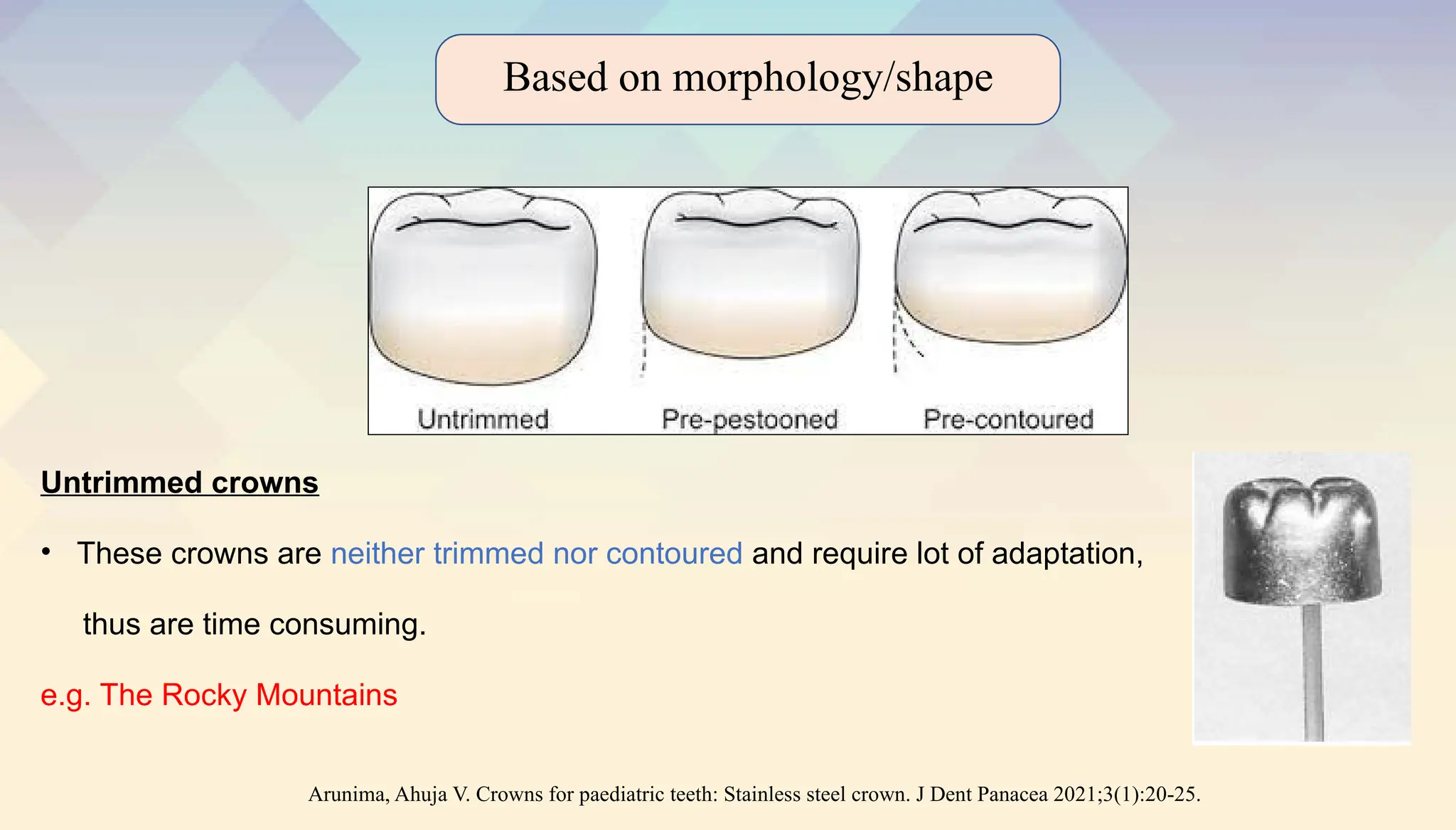stainless steel crowns in pediatric dentistry | PPTX