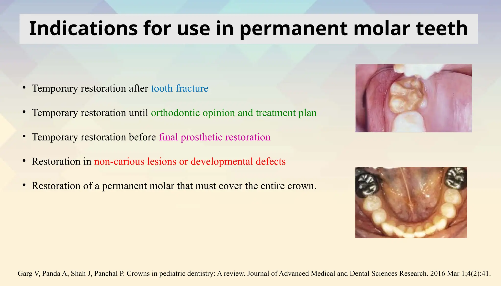 stainless steel crowns in pediatric dentistry | PPTX