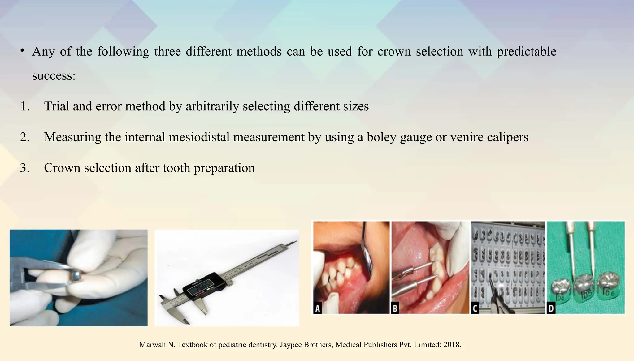 stainless steel crowns in pediatric dentistry | PPTX
