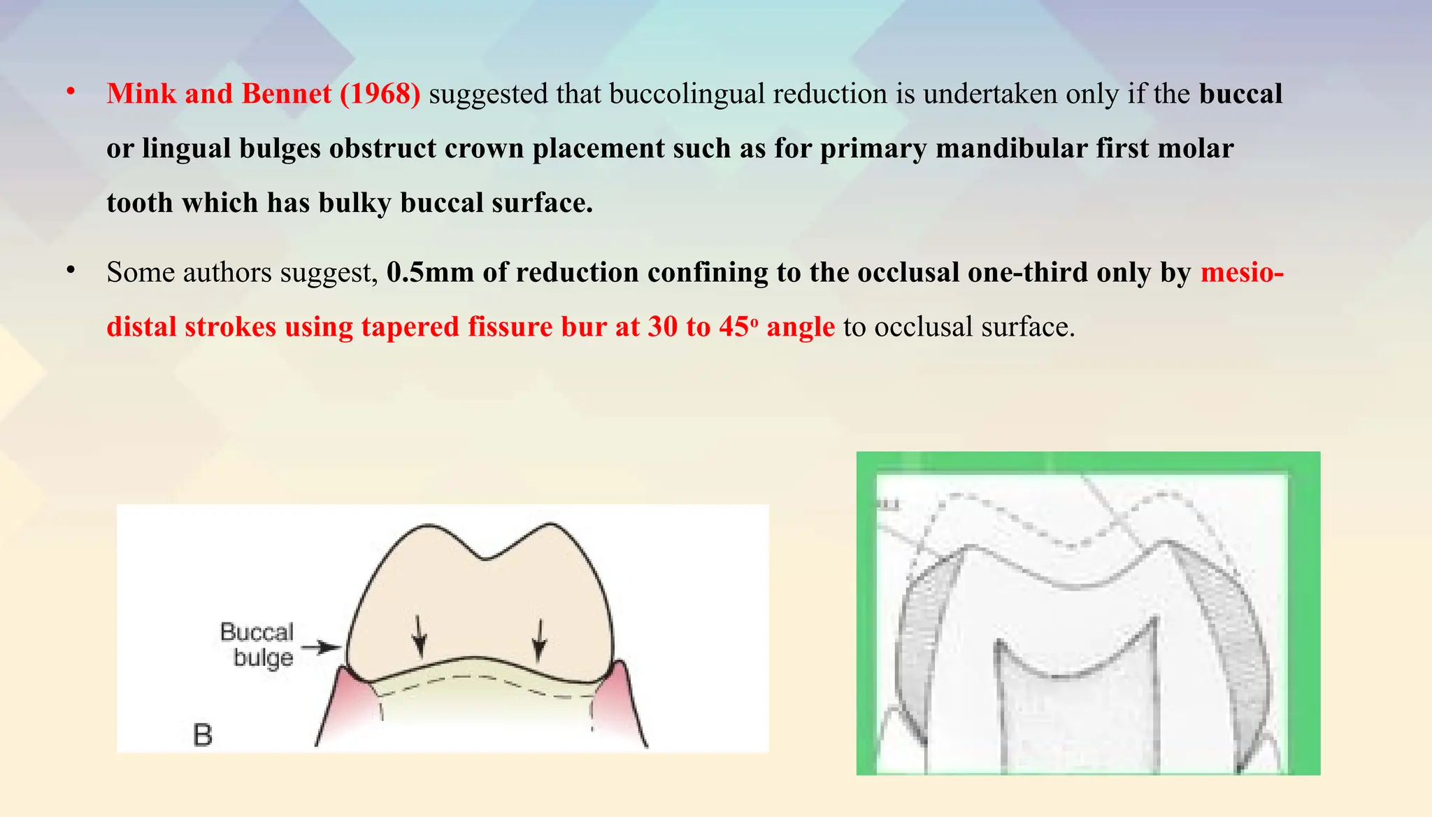 stainless steel crowns in pediatric dentistry | PPTX
