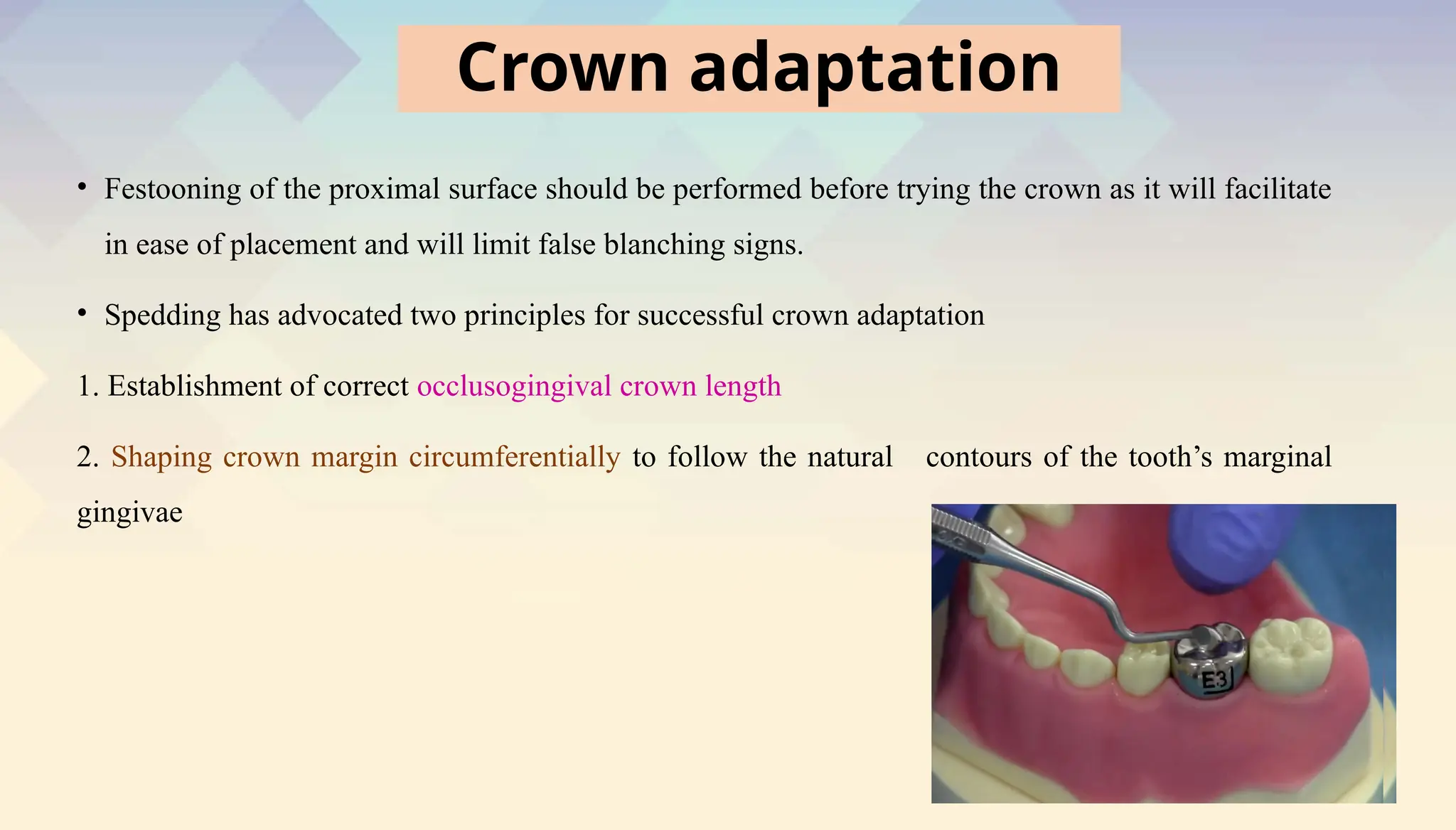 stainless steel crowns in pediatric dentistry | PPTX