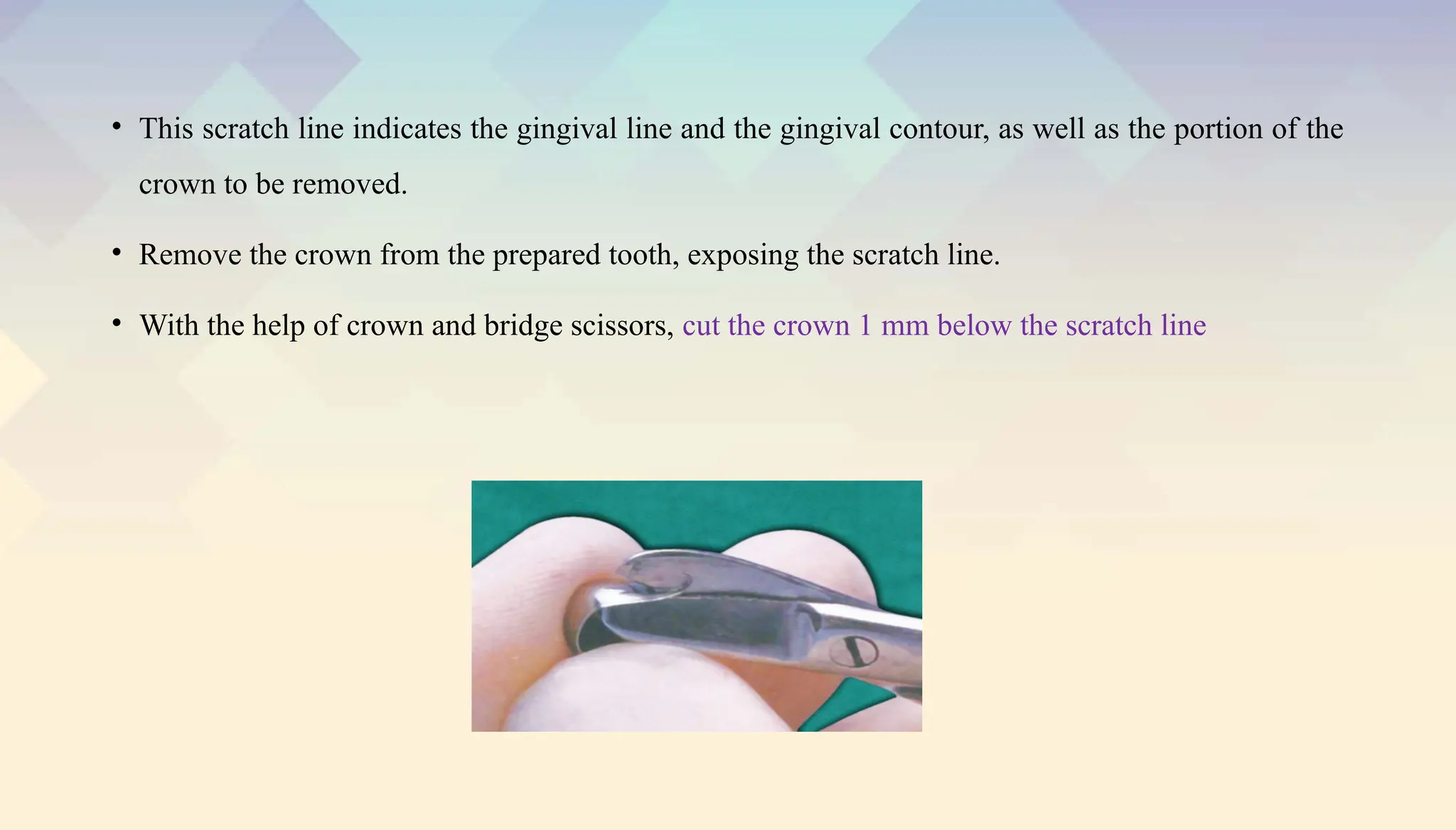 stainless steel crowns in pediatric dentistry | PPTX